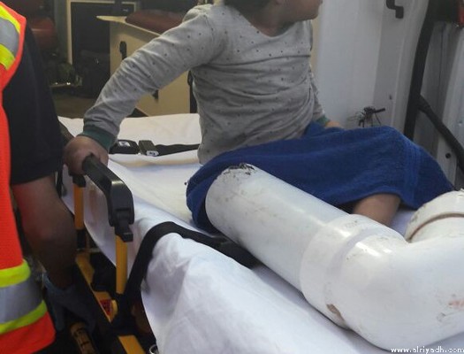 KSA: Child's leg gets stuck in toilet