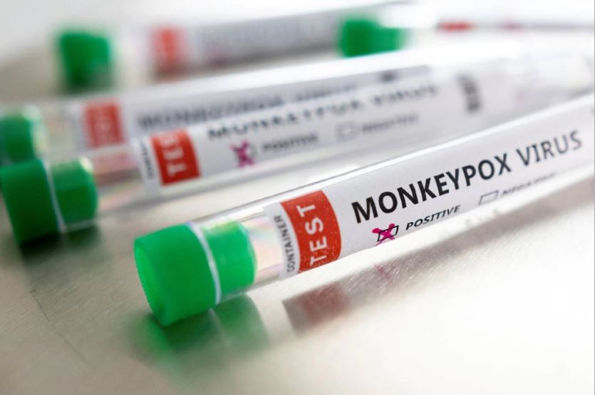 Letters: Use Covid-19 experience to combat monkeypox