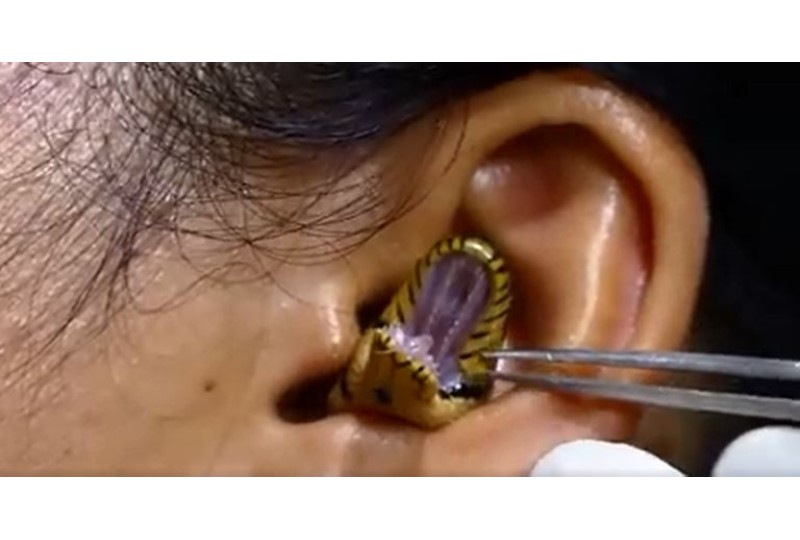 OMG: REAL OR FAKE: Viral video of snake stuck in woman's ear divides ...