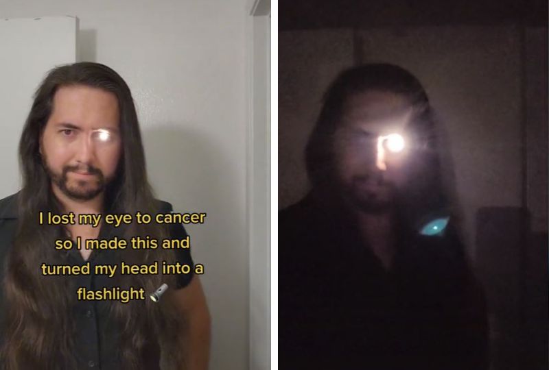OMG: VIDEO: Man turns right eye socket into flashlight after losing ...
