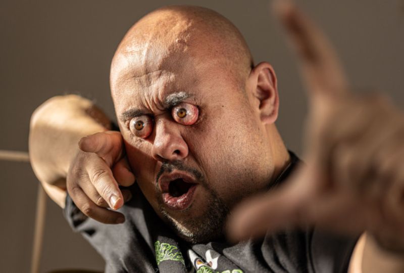 OMG: Uruguayan man sets new world record for 'farthest eyeball pop'